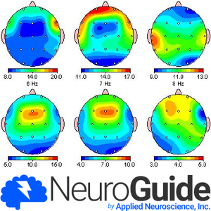 Neuroguide Software – Mind Media Group